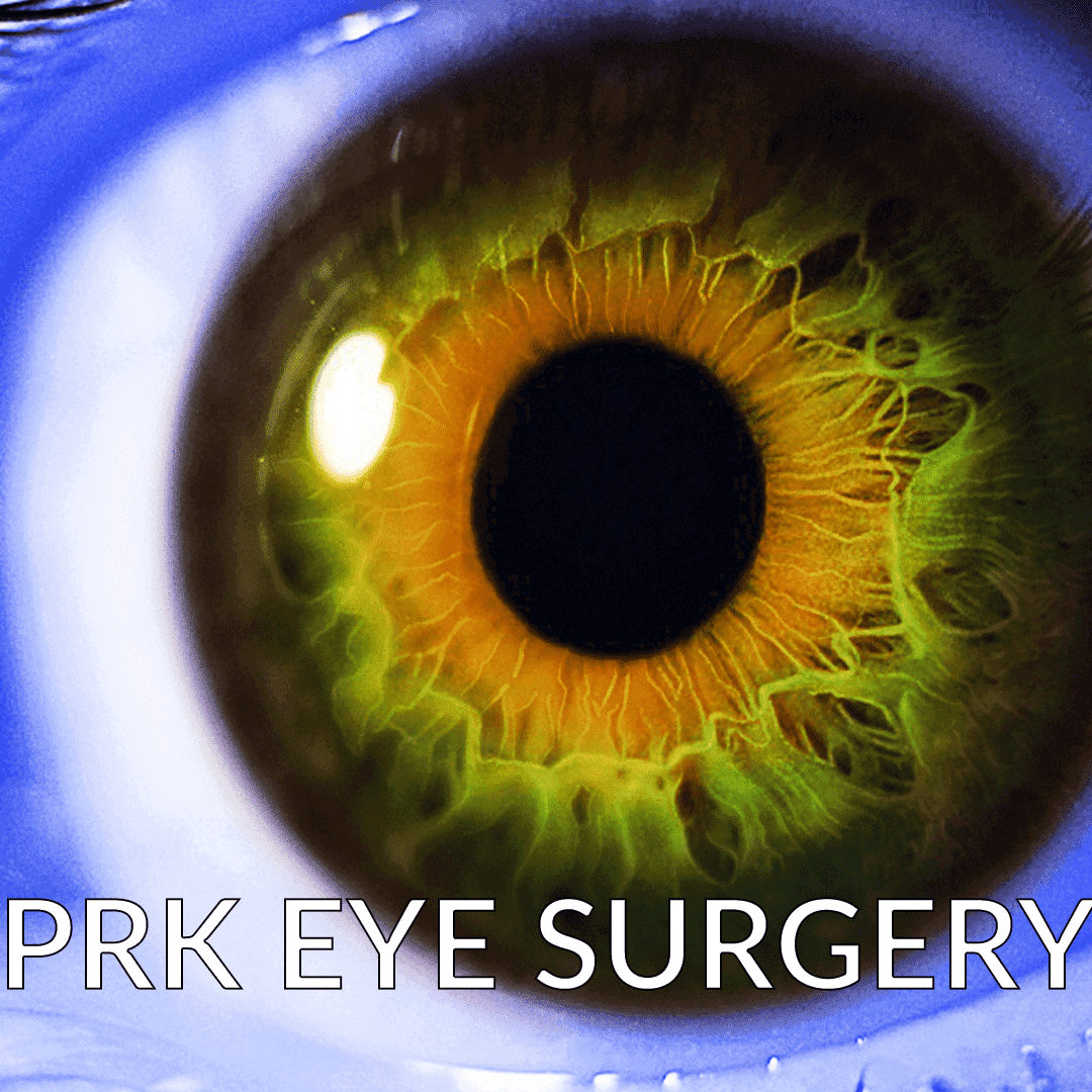 PRK Dallas | PRK Frisco | Texas Eye Surgeons