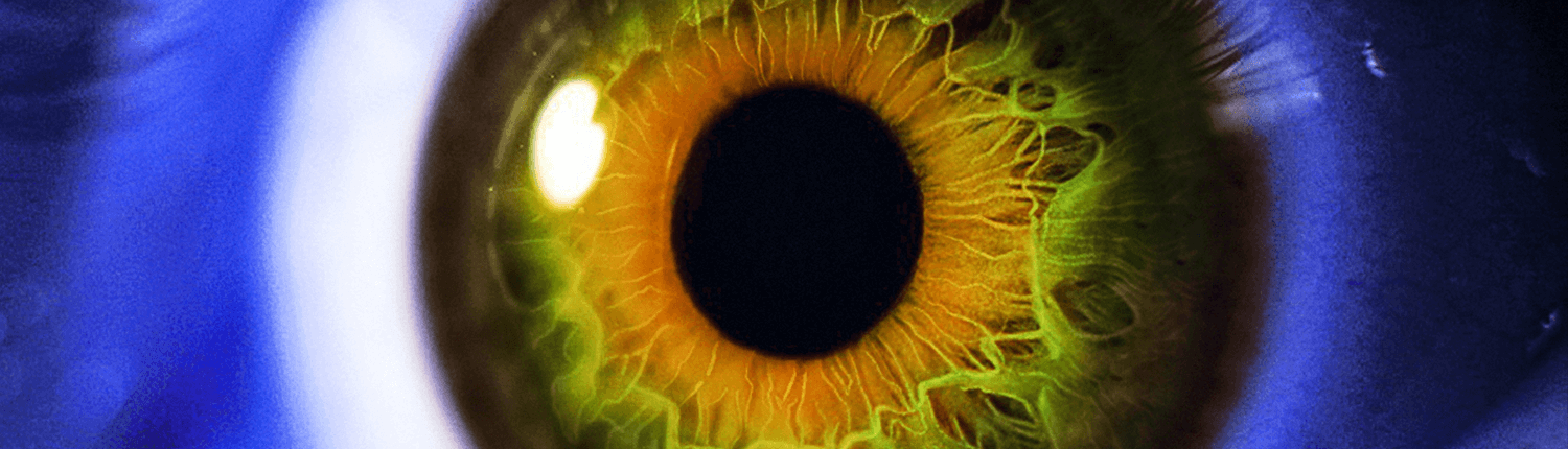 YAG Capsulotomy Plano | Dallas - Fort Worth | Texas Eye Surgeons